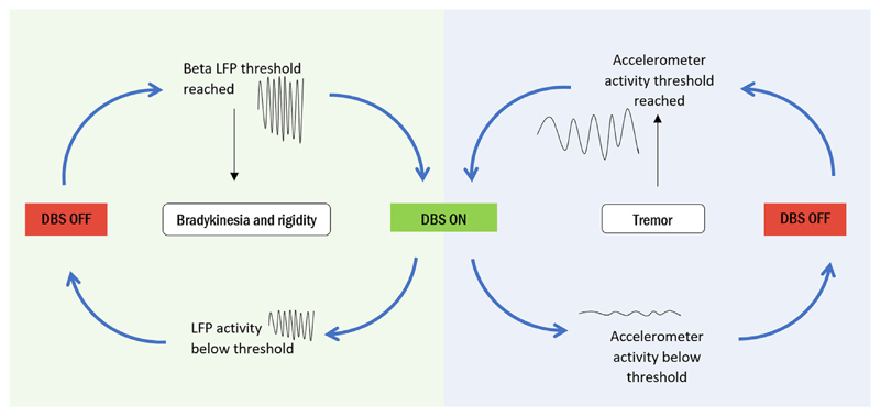 Adaptive Deep Brain Stimulation for Movement Disorders: The Long Road ... Adaptive Deep Brain Stimulation for Movement Disorders: The Long Road ...